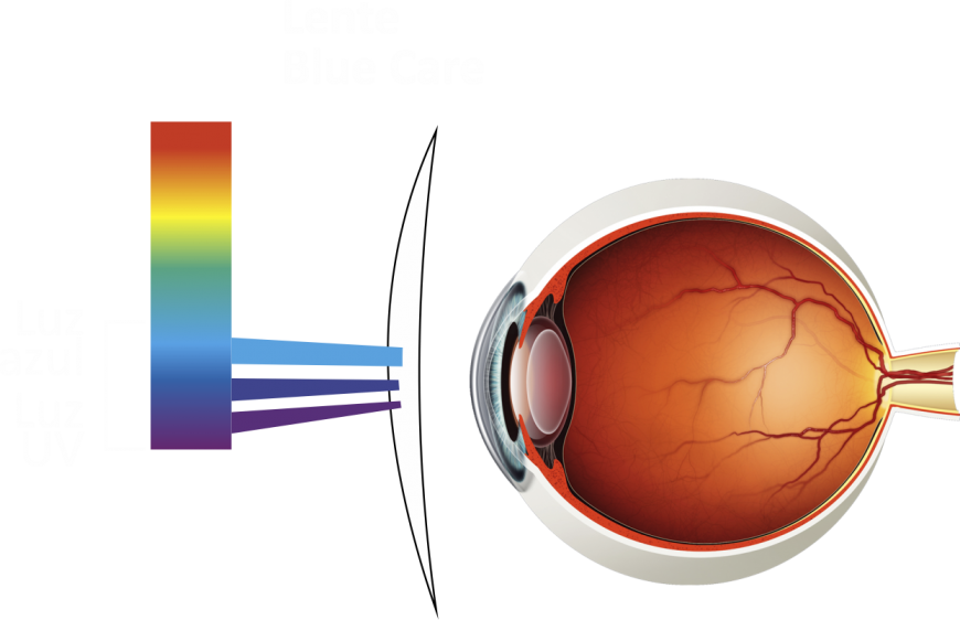 Lentes Blue Care – Best Optical